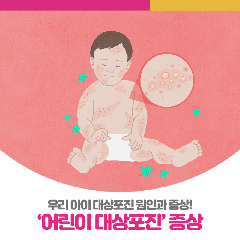 하단아동병원 우리 아이 대상포진 원인과 증상 네이버 블로그